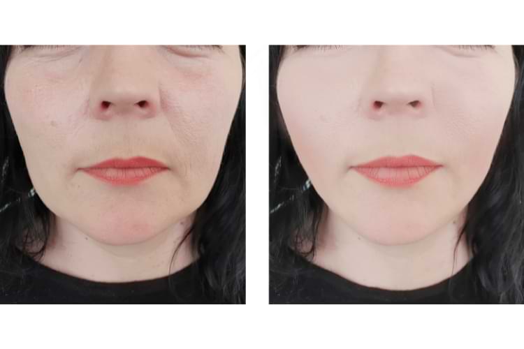 Mon Avis d’Esthéticienne sur la Wellbox LPG